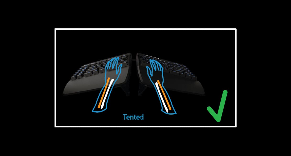 KinesisGaming Freestyle Edge Split Gaming Keyboard | Shop Freestyle ...